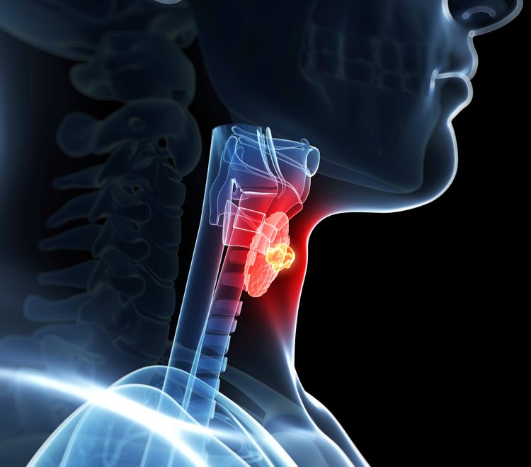 Thyroid